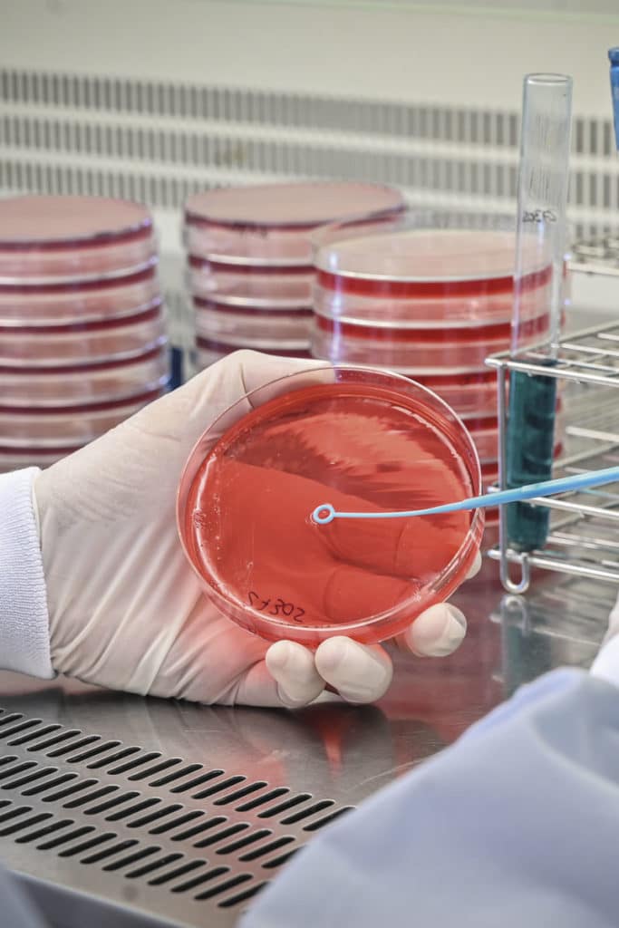 Identification of micro-organisms in food | AINIA