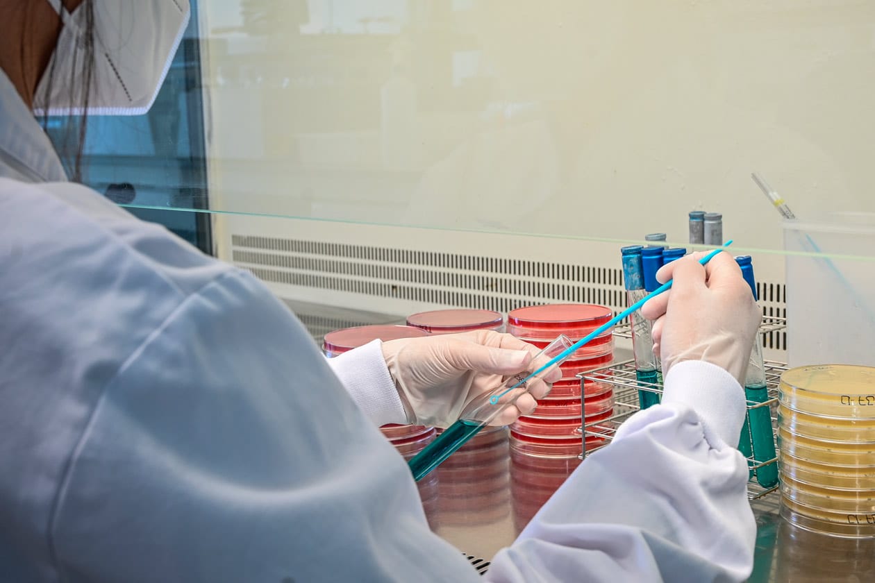 Analysis of viruses in food | AINIA